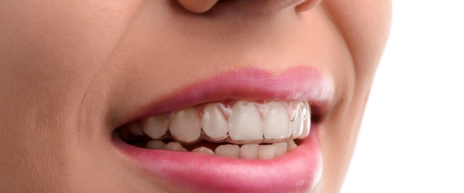 Does Invisalign Treatment Hurt? An Expert's Perspective